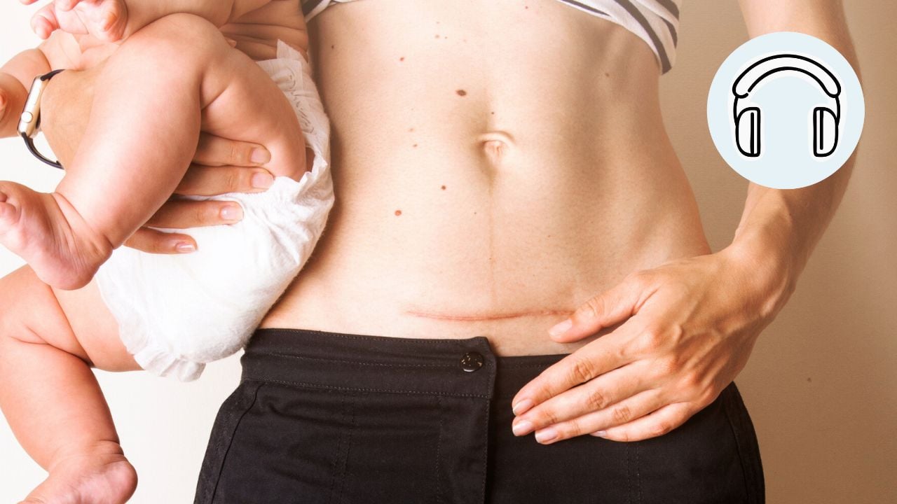 Planlagt kejsersnit: Forbered dine mavemuskler | Superfit Mor